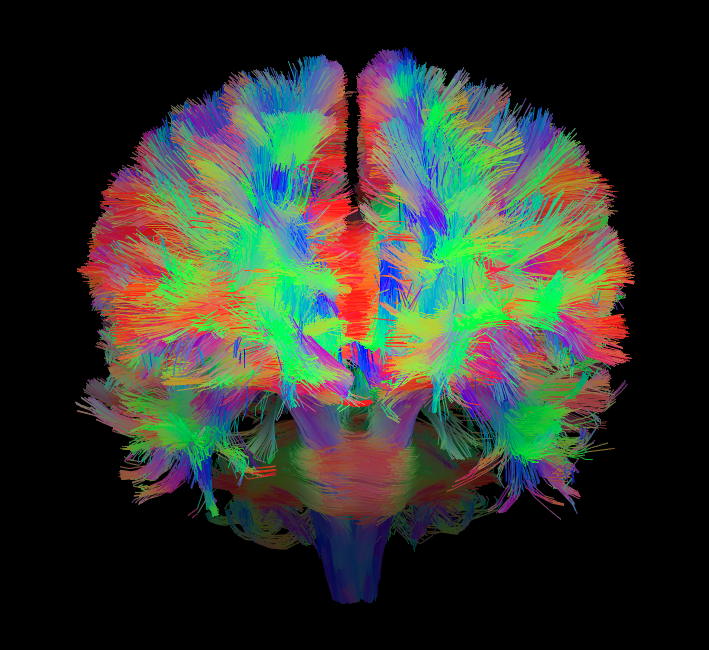 dMRI Tractography